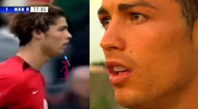 Les Secrets Des Chirurgies Esthétiques De Cristiano Ronaldo
